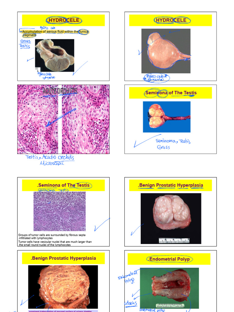 MALE & FEMALE OSPE (5 Files Merged) | PDF