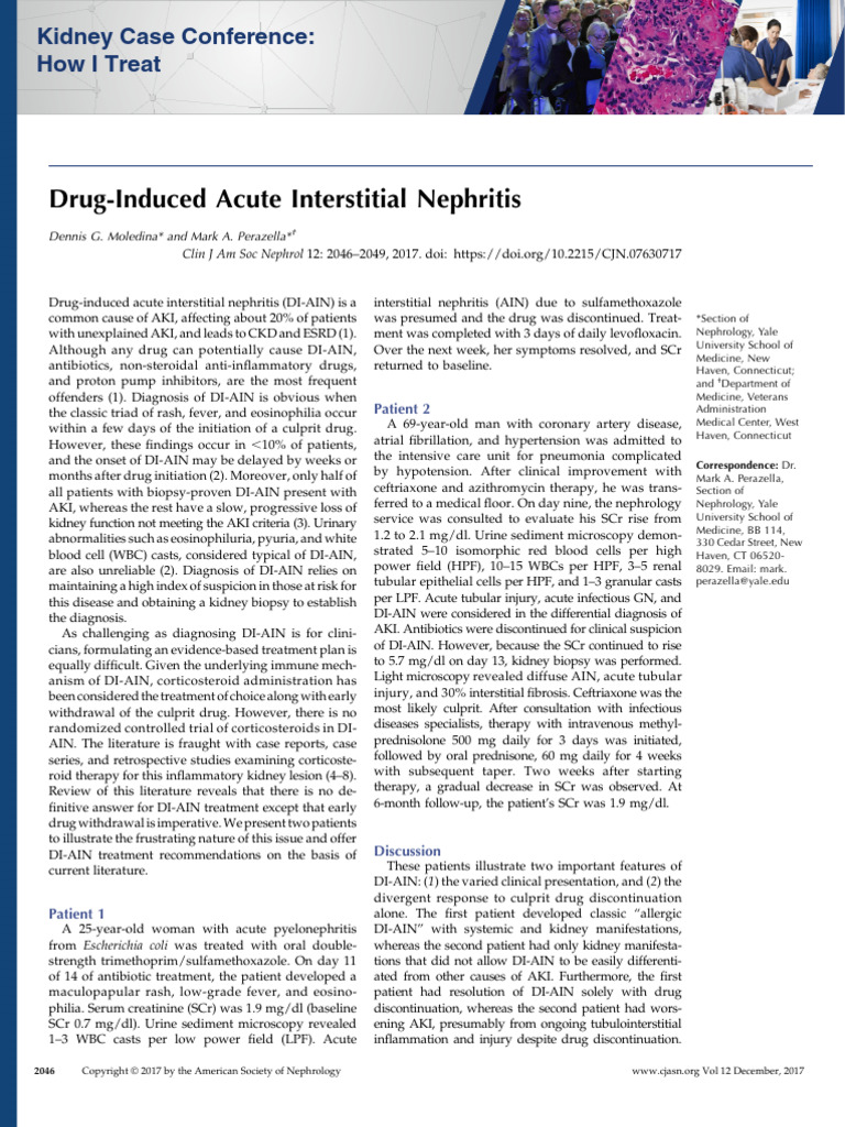 Drug Induced Acute Interstitial Nephritis.18 | PDF