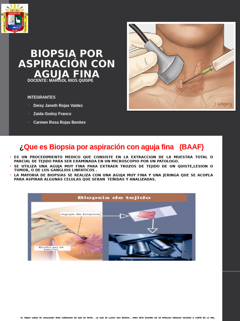 Biopsia Por Aspiración Con Aguja Fina Exposision | PDF
