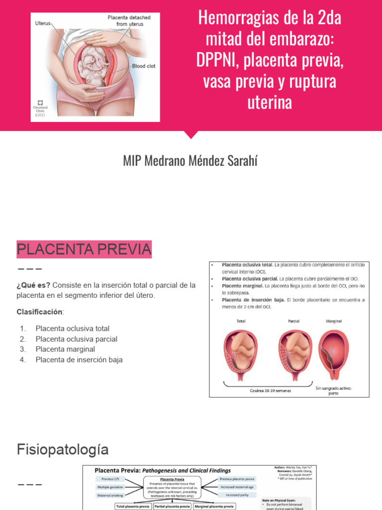 Expo Gine Internado Dppni y Placenta Previa | PDF
