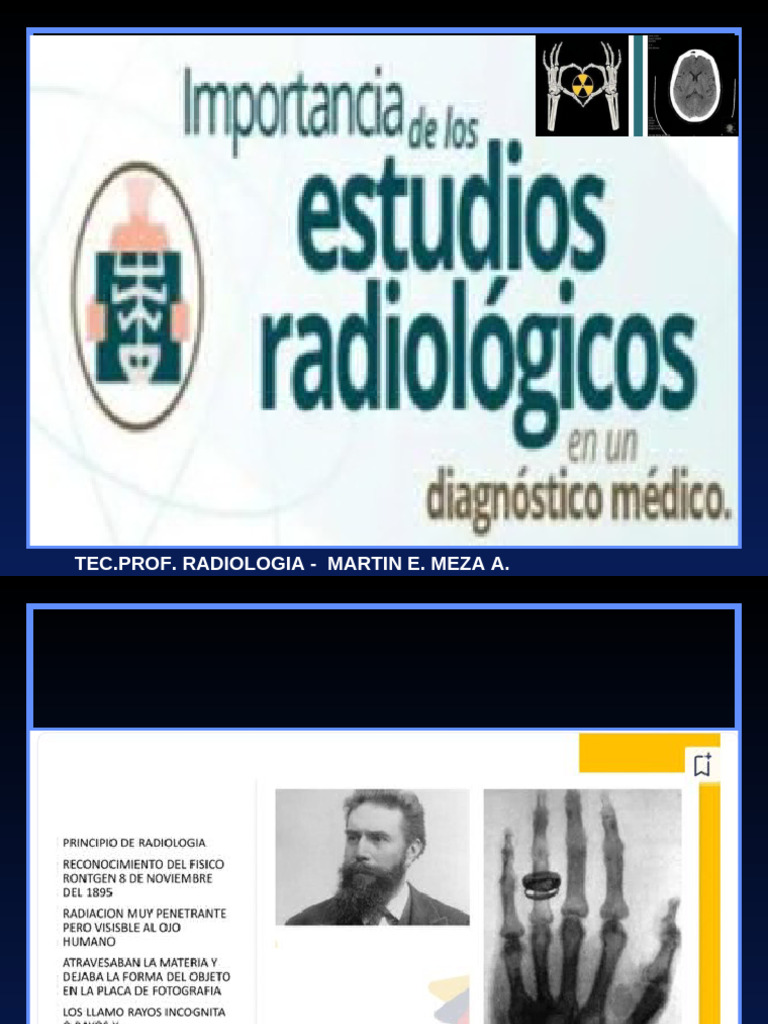 Importancia de Los Estudios Radiologicos en Un Diagnostico Medico | PDF