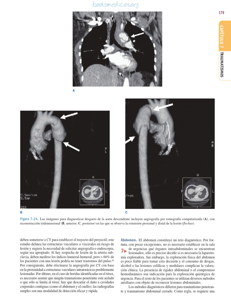 TRAUMA ABDOMINAL | PDF