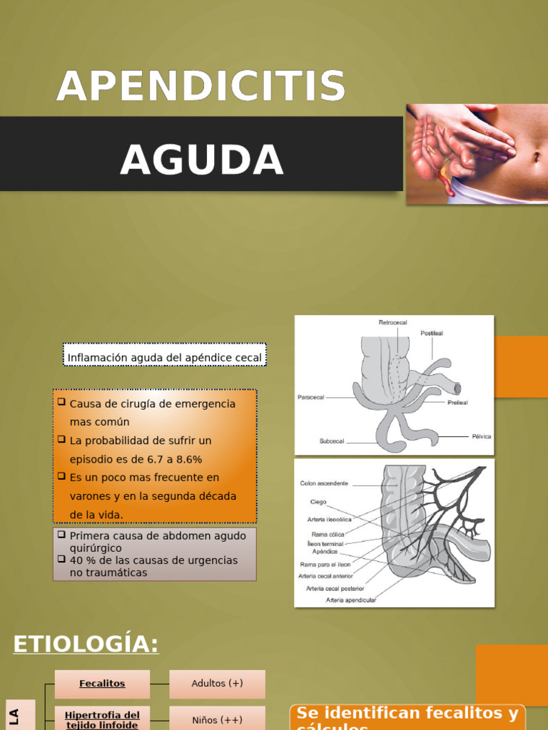 Apendicitis Aguda | PDF