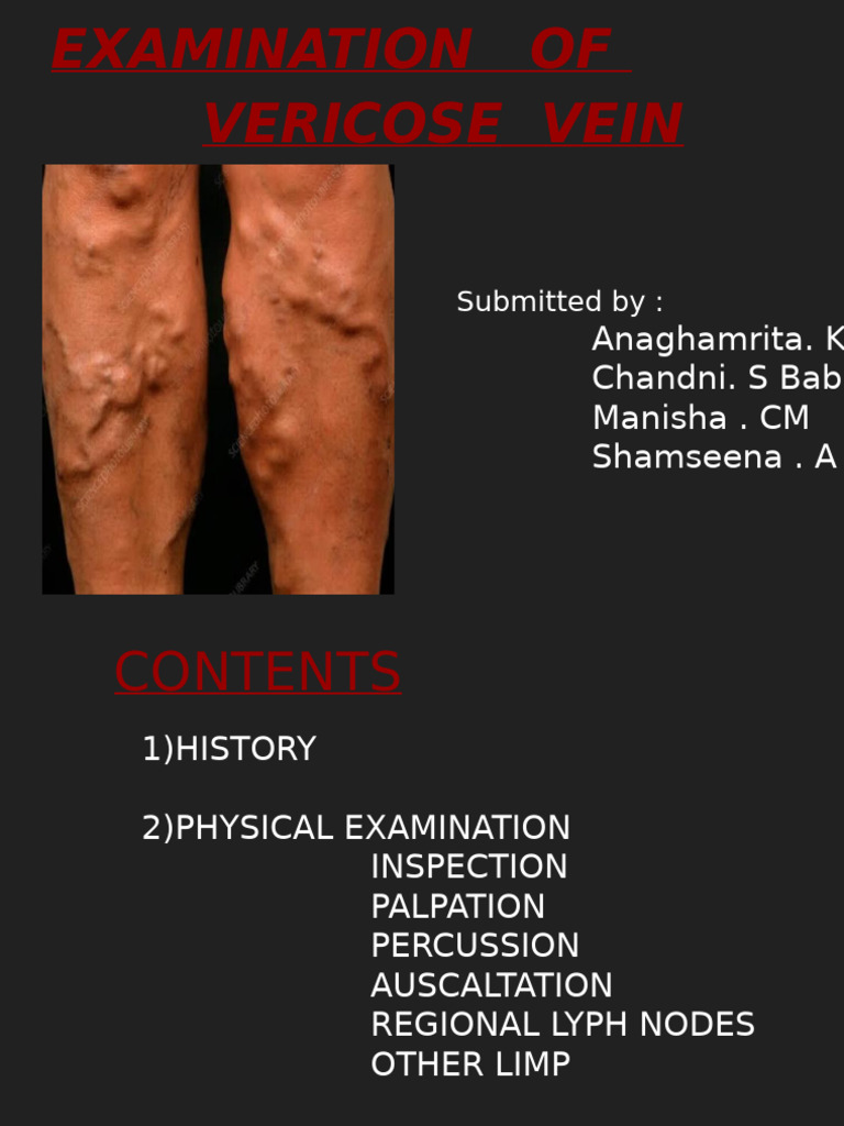 Vericose Vein Ppt-1 | PDF