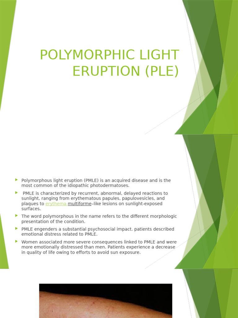 Polymorphic Light Eruption (Ple) | PDF