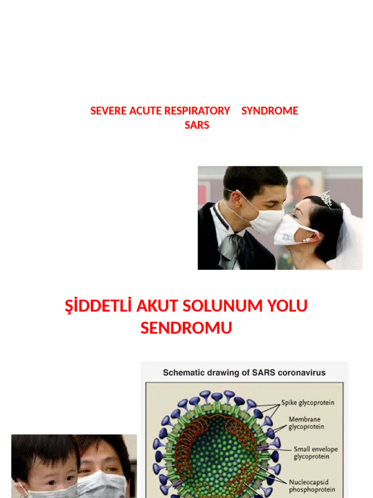 7 Sars Avian Inf. Swine Flu | PDF