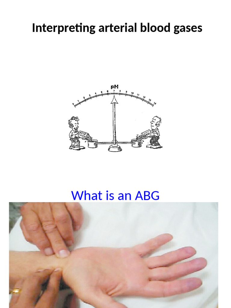 Interpreting Arterial Blood Gases | PDF