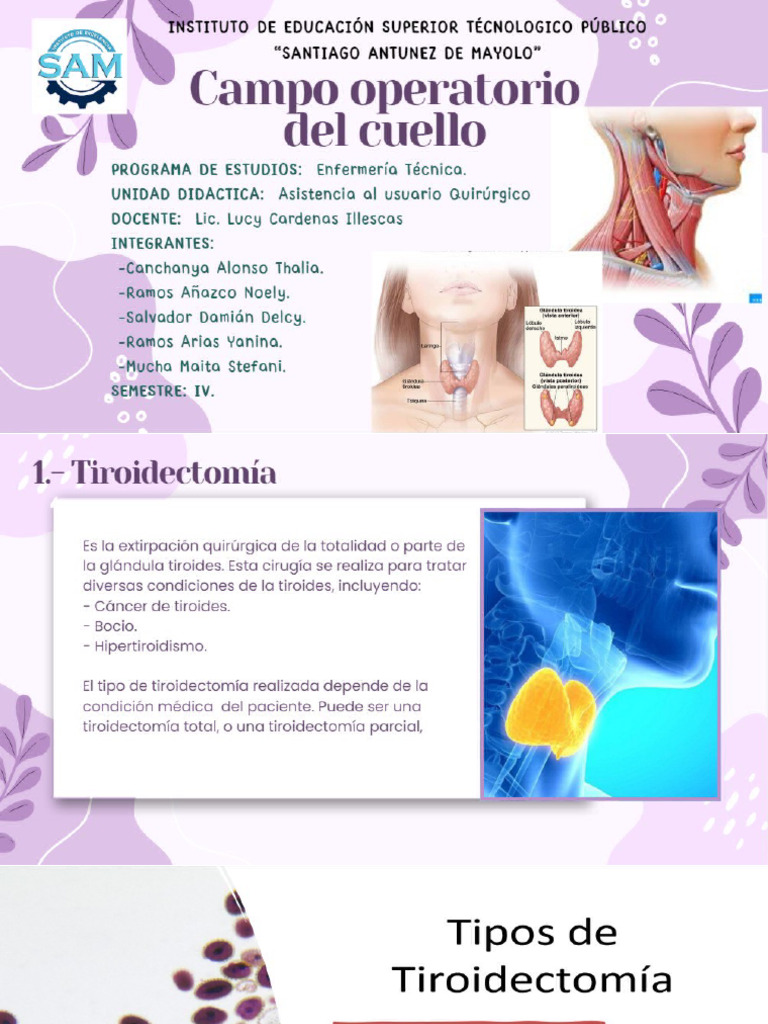 TIROIDECTOMÍA | PDF