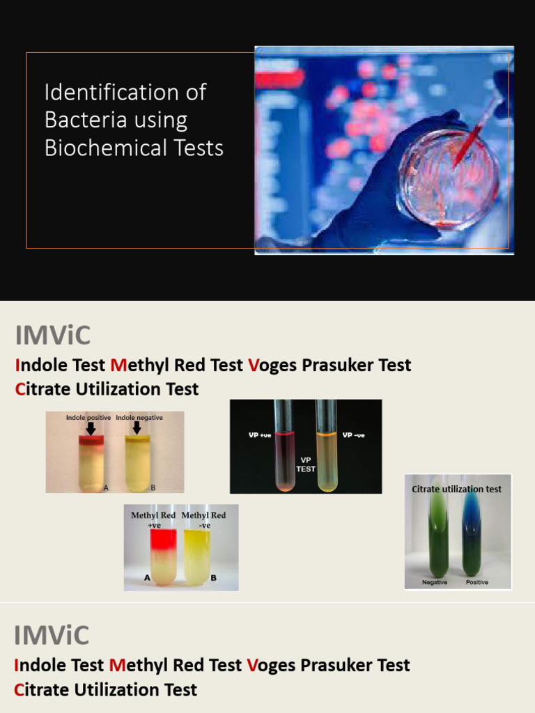 IMViC | PDF