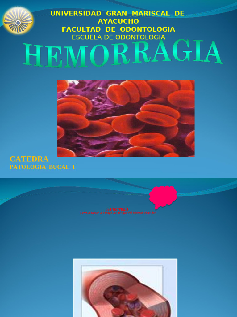 Hemorragia | PDF