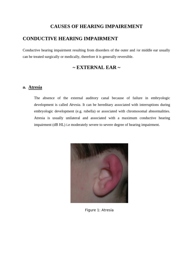 6) Classification _ Causes of Hearing Loss | PDF