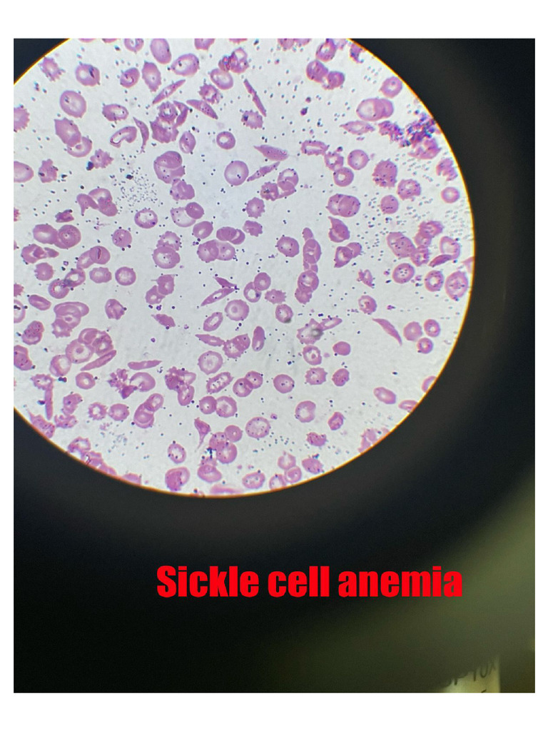 Patho Practical slides | PDF