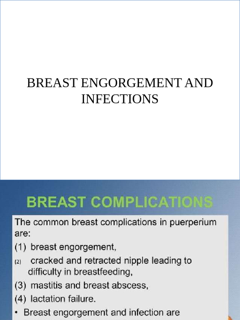 Breast Engorgement and Infections | PDF