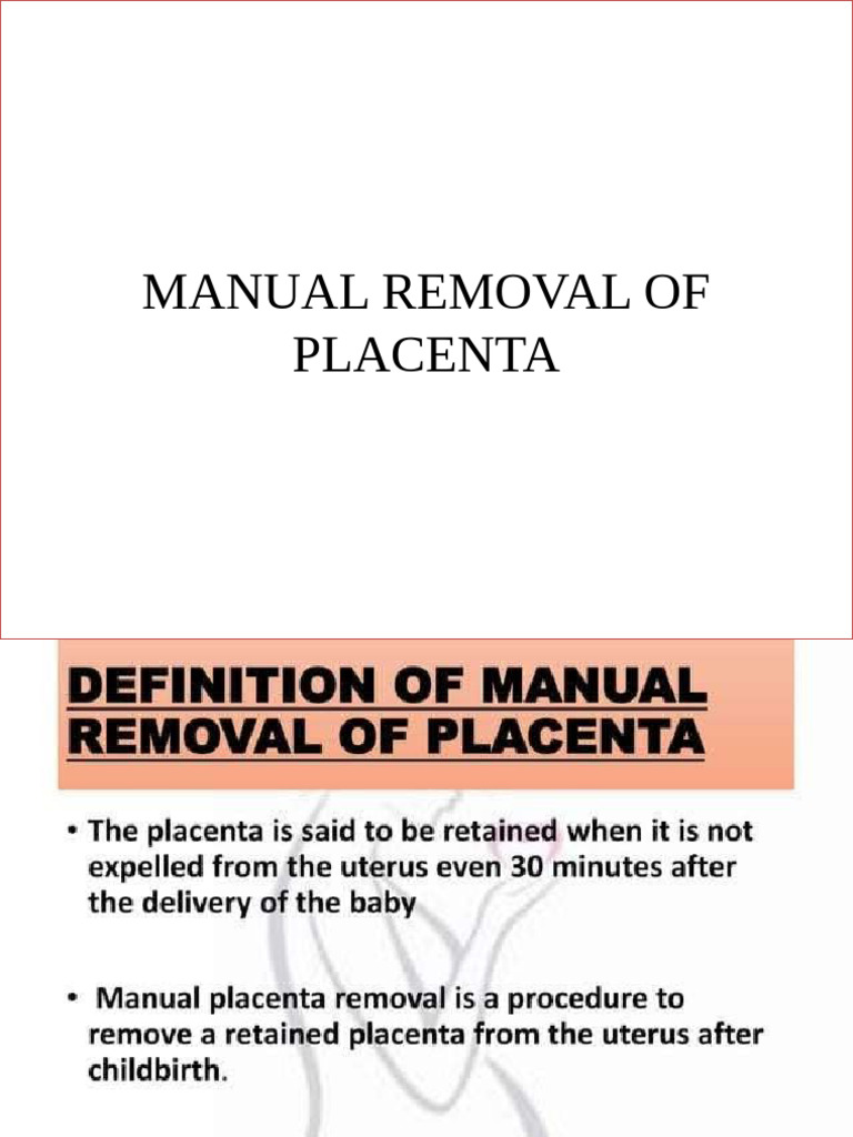 Manual Removal of Placenta | PDF