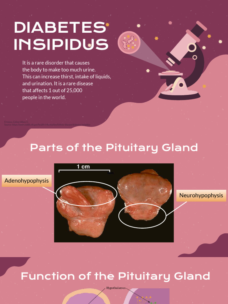 MLS 2 - Diabetes Insipidus | PDF