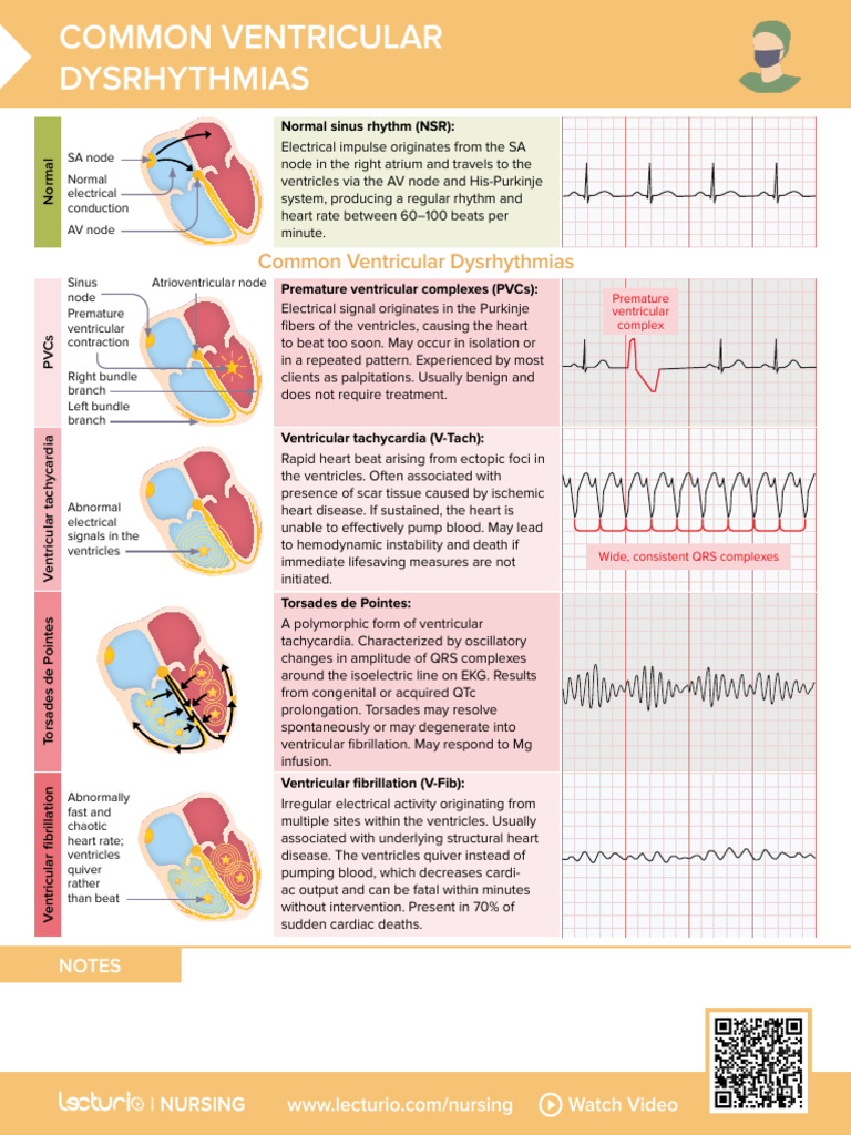 Ventricular Dysrhythmias | PDF
