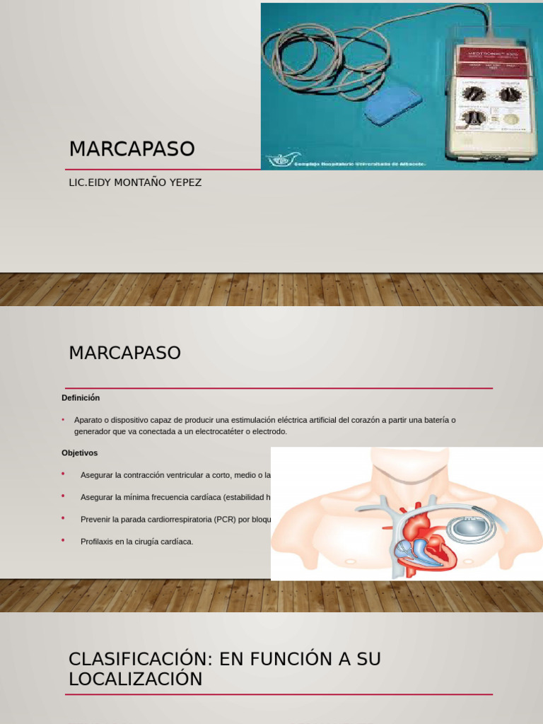 MARCAPASO DIAPOSITIVAS 26 Actualizado | PDF