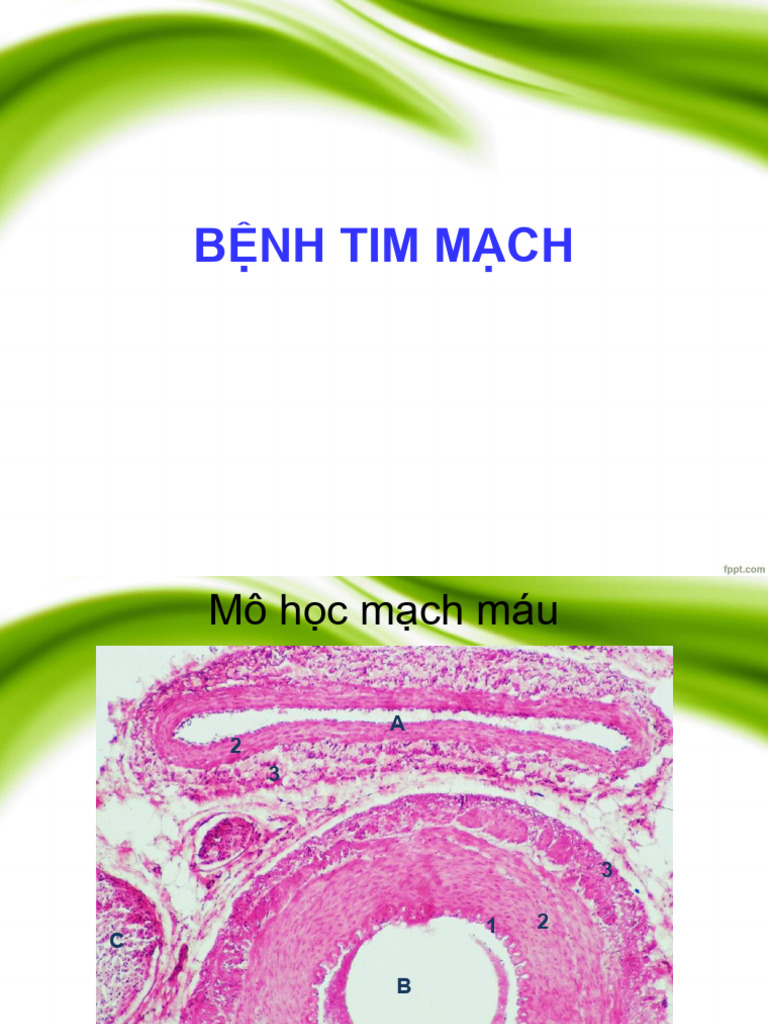 Benh Tim Mach | PDF