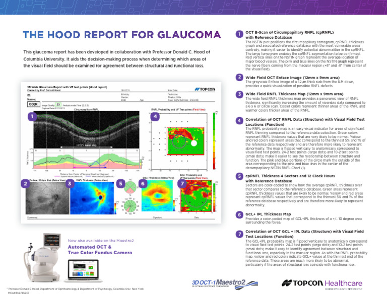 Hood Report For Glaucoma-Maestro | PDF
