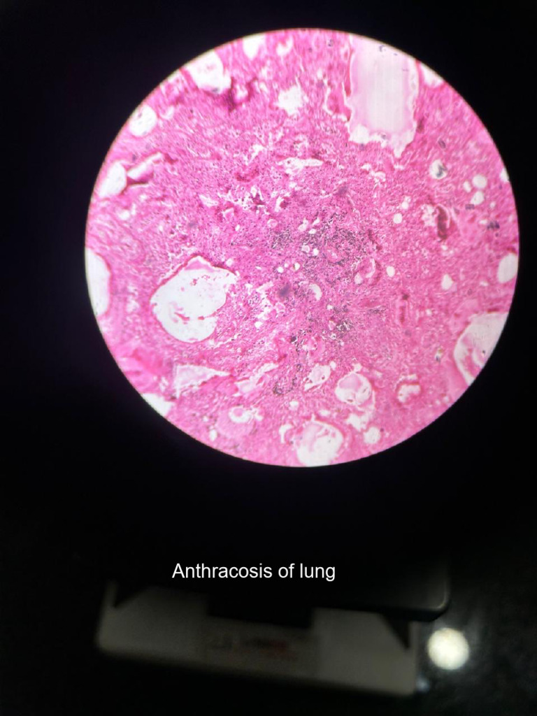 Spotters - Pathology 2 | PDF