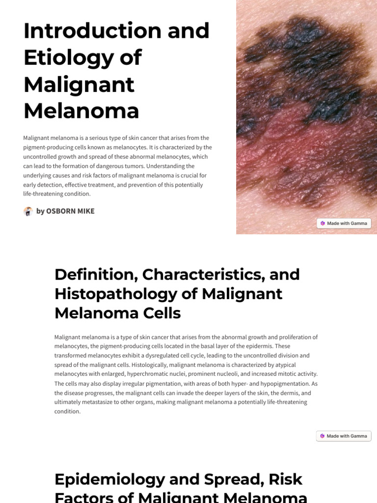 Introduction and Etiology of Malignant Melanoma | PDF