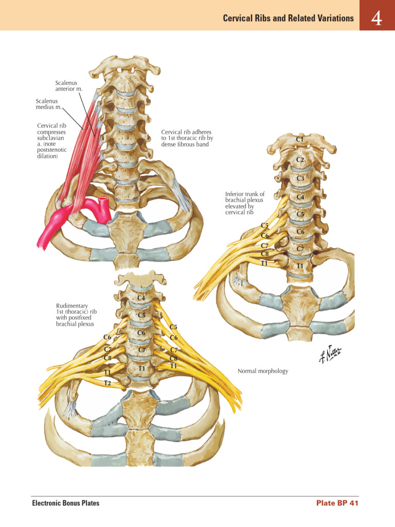 Cervical Ribs and Related Variations: C1 C2 C3 C4 C5 C6 C7 T1 | PDF