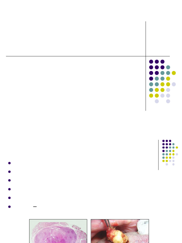 Tema 15-Neoplasia V. Tumores epitelials APG 22 | PDF