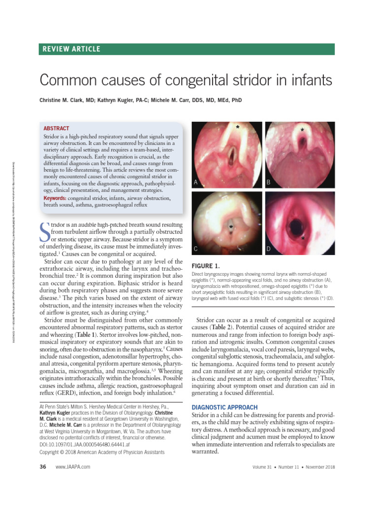 Common causes of congenital stridor in infants_2018 | PDF