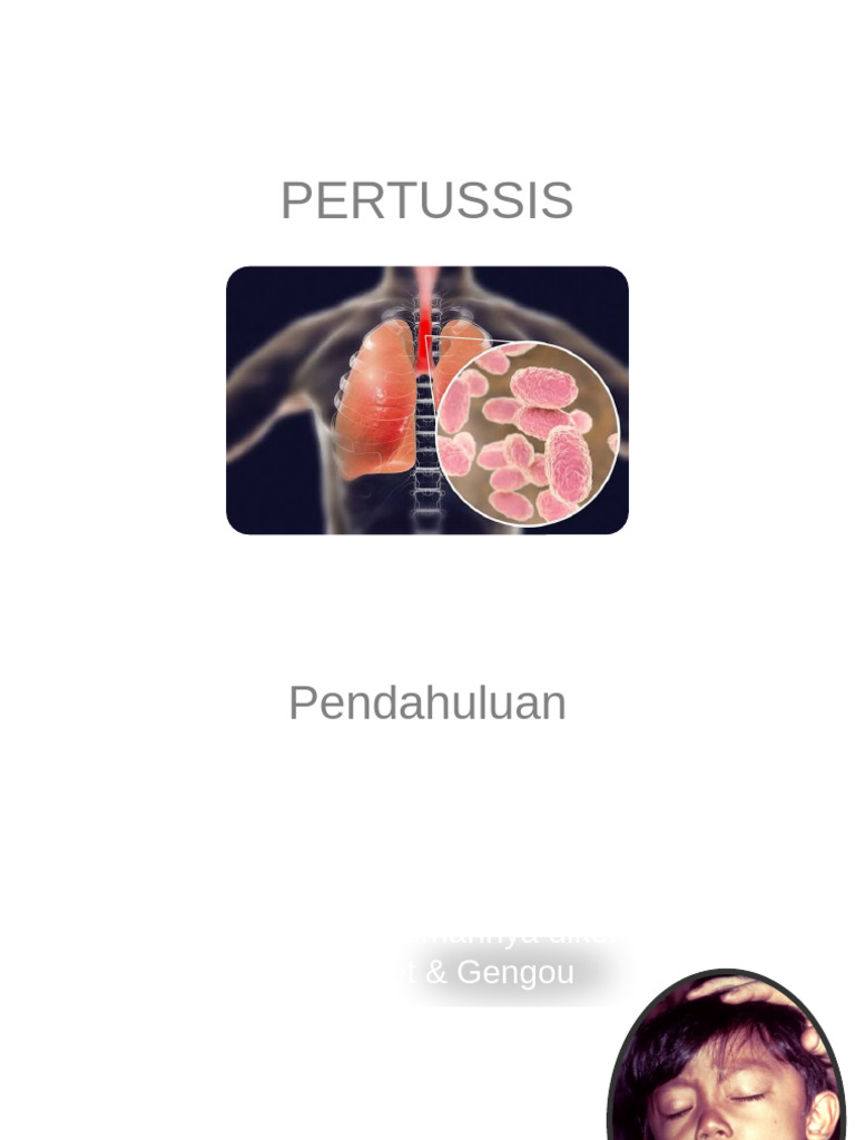 PERTUSSIS PPT | PDF