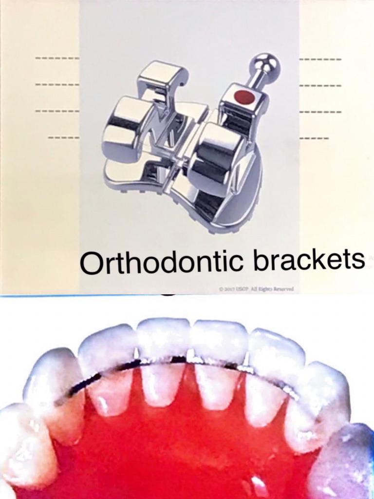 Ortho Spotters | PDF