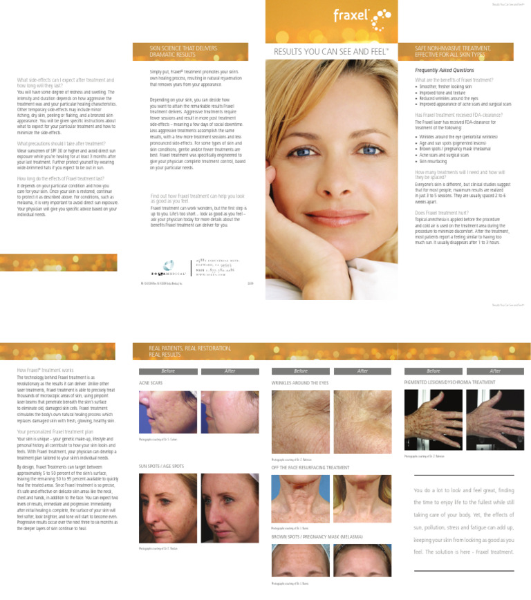 Fraxel Brochure | PDF