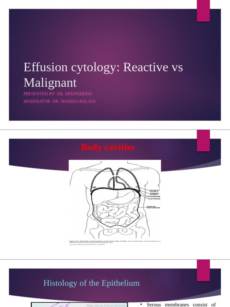 Calretinin in Effusion Cytology Analysis | PDF | Cell Nucleus | Ovarian ...