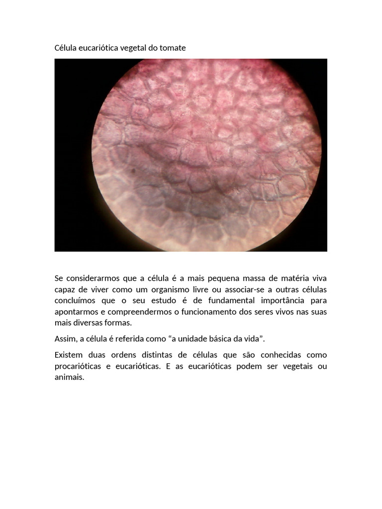 Célula Eucariótica Vegetal Do Tomate Pdf