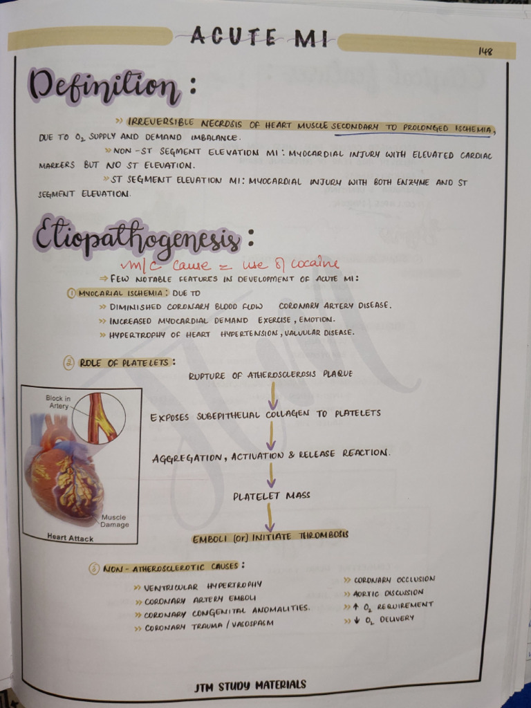 Acute MI | PDF