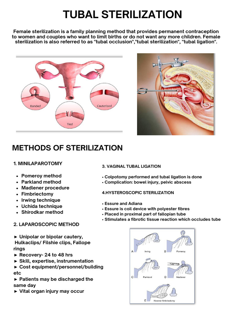 Tubal Sterlization PDF | PDF