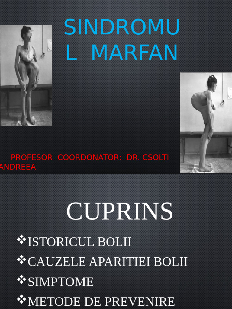 Sindromul Marfan | PDF
