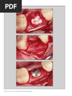 Cawood - Howell 1988 | PDF | Dentistry Branches
