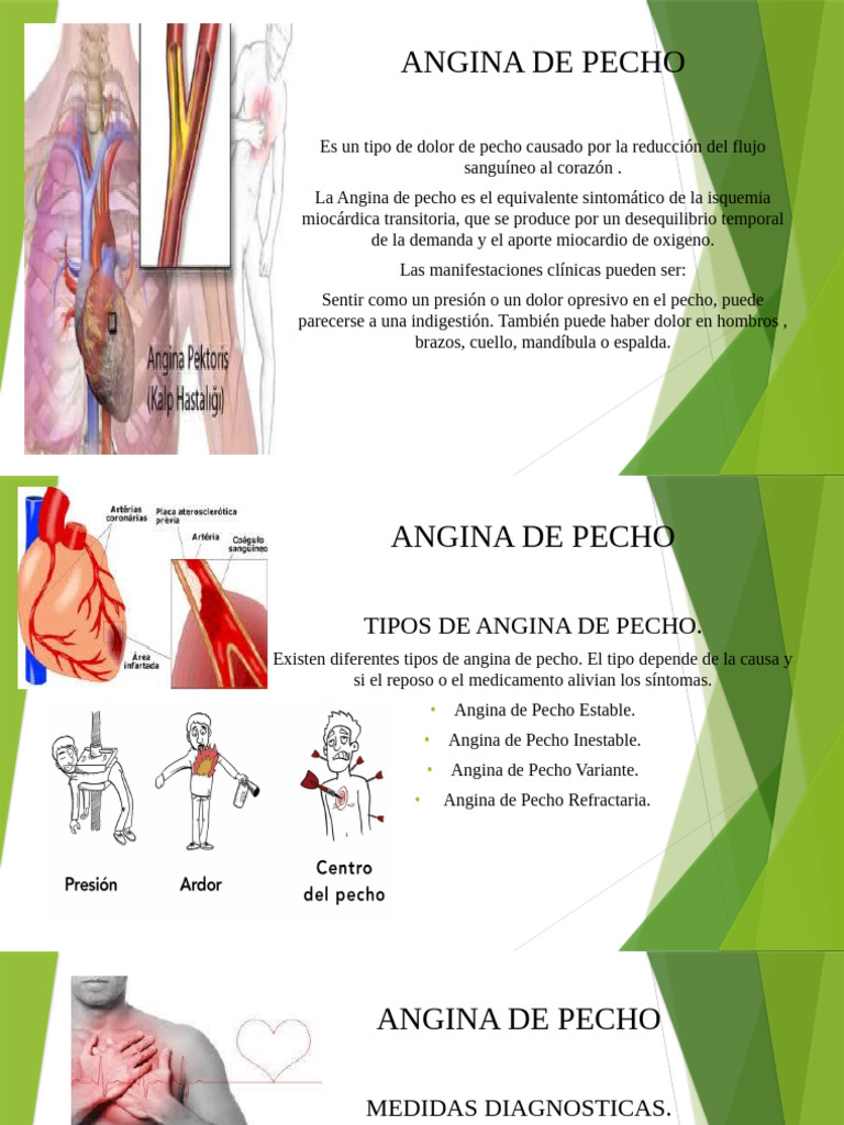 Presentación1 Angina de Pecho | PDF