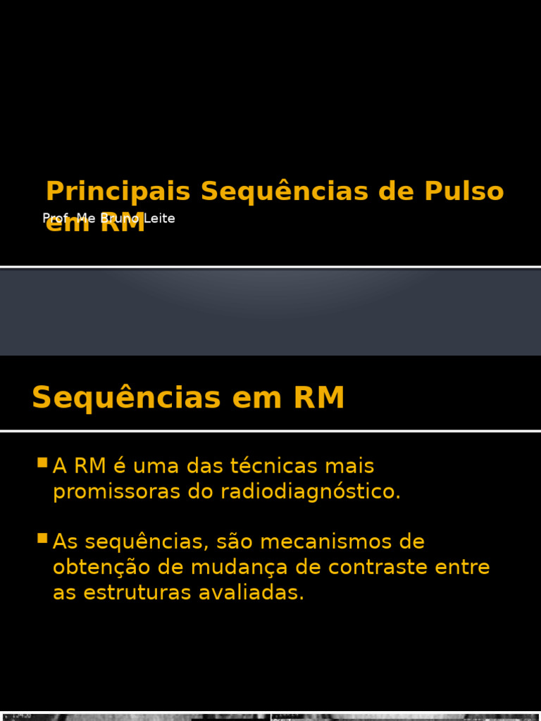 Principais Sequências em RM | PDF