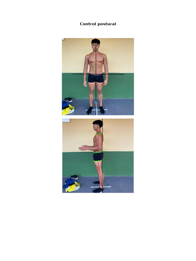 Control Postural | PDF
