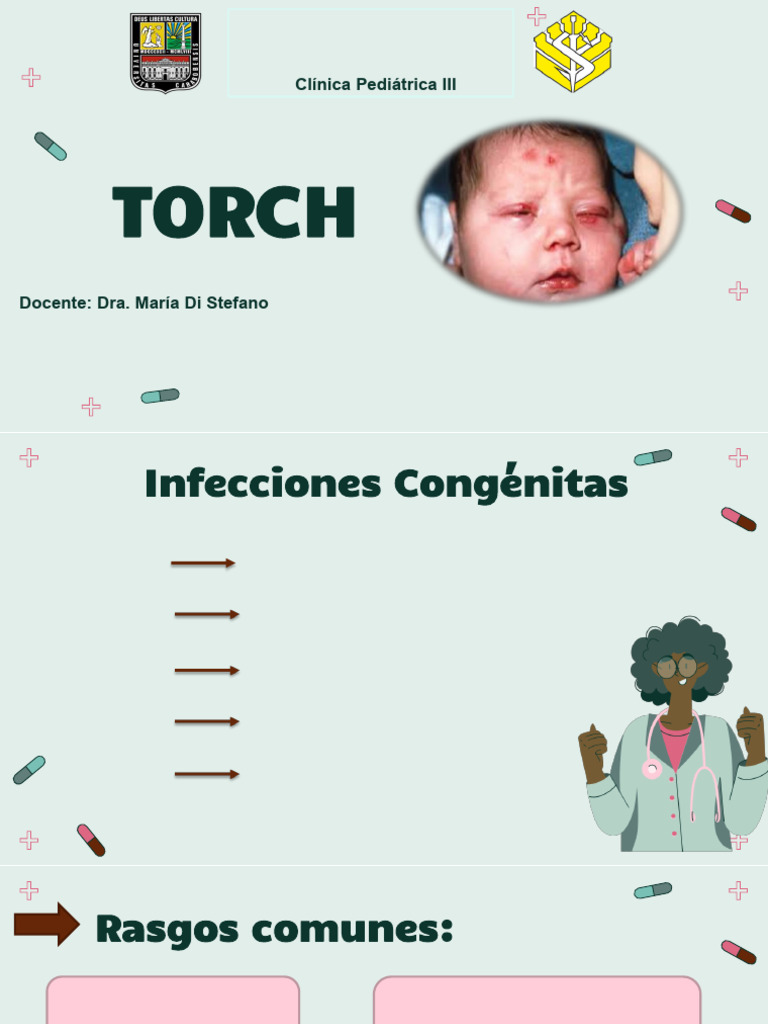 Torch | PDF