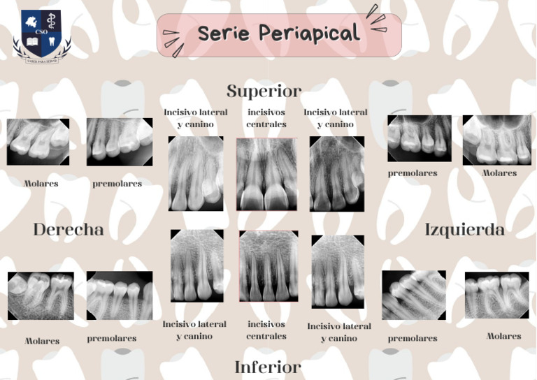 Serie Periapical Completa | PDF
