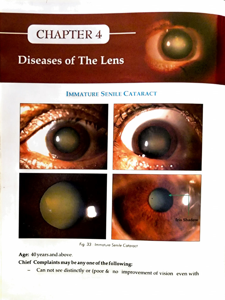 IMSC | PDF