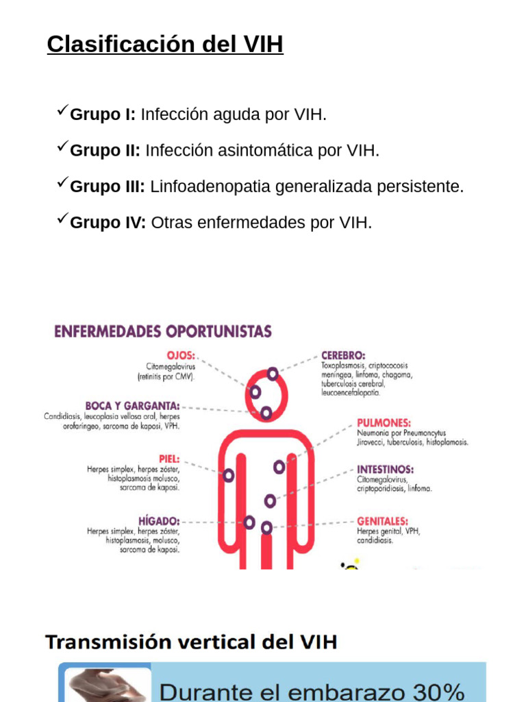 Presentación_VIH 2_103337 | PDF