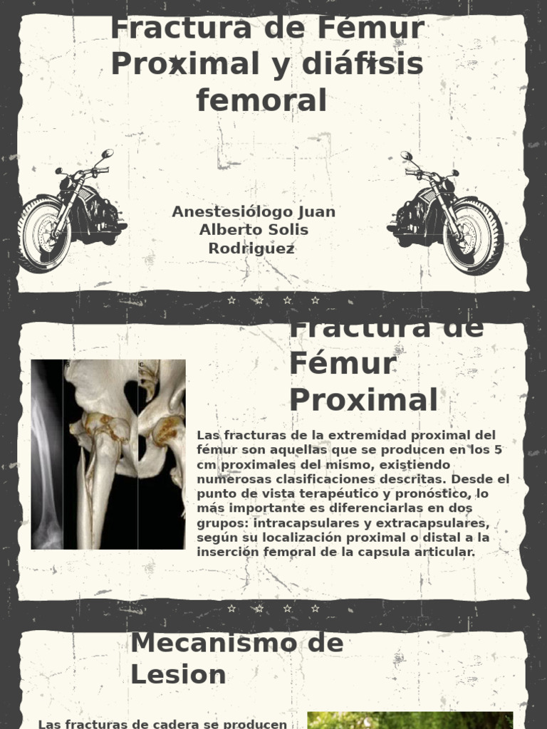 Fractura de Humero Proximal y Diafisis Humeral | PDF
