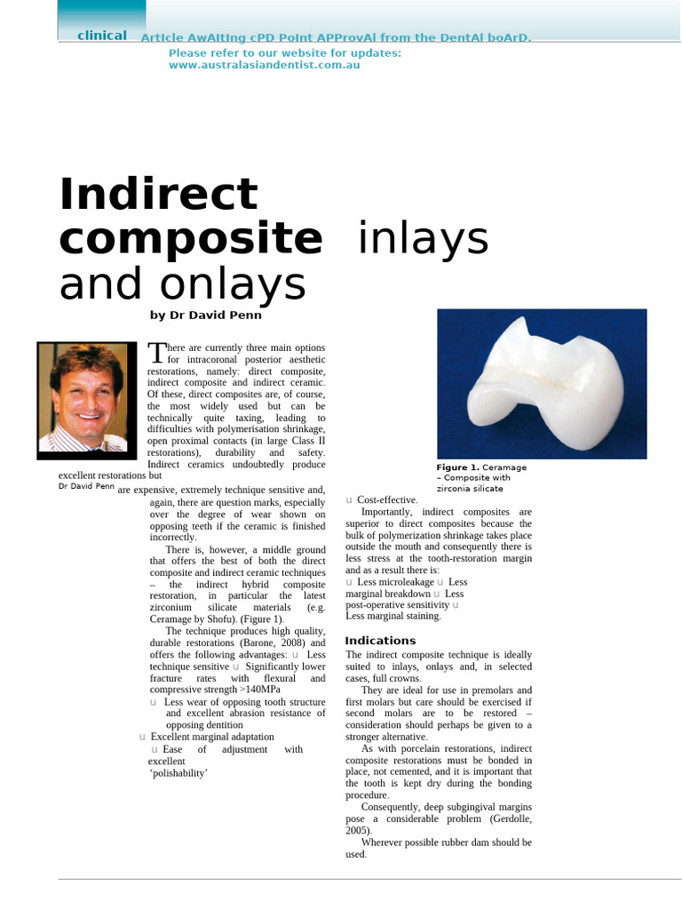 134428976-Indirect-Composite-Inlays-and-Onlays 1 | PDF