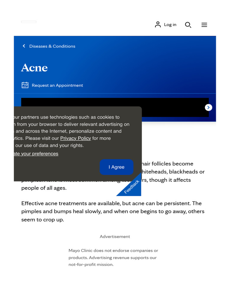 Acne - Symptoms and causes - Mayo Clinic | PDF