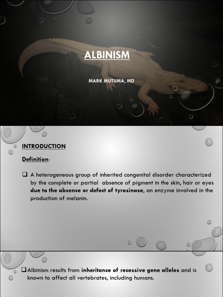 Albinism DR Mark | PDF