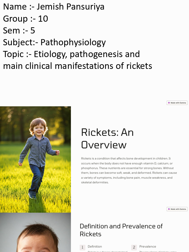 Rickets an Overview (1) | PDF
