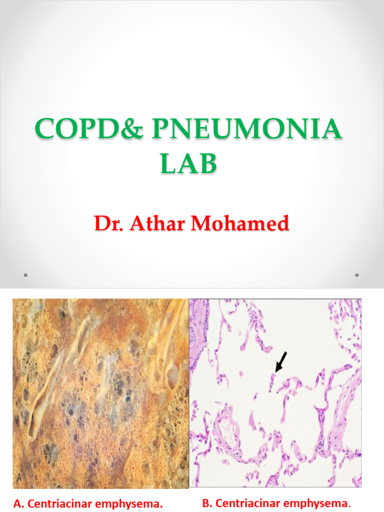 Patho Copd And Pneumonia Lab Dr Athar Pdf